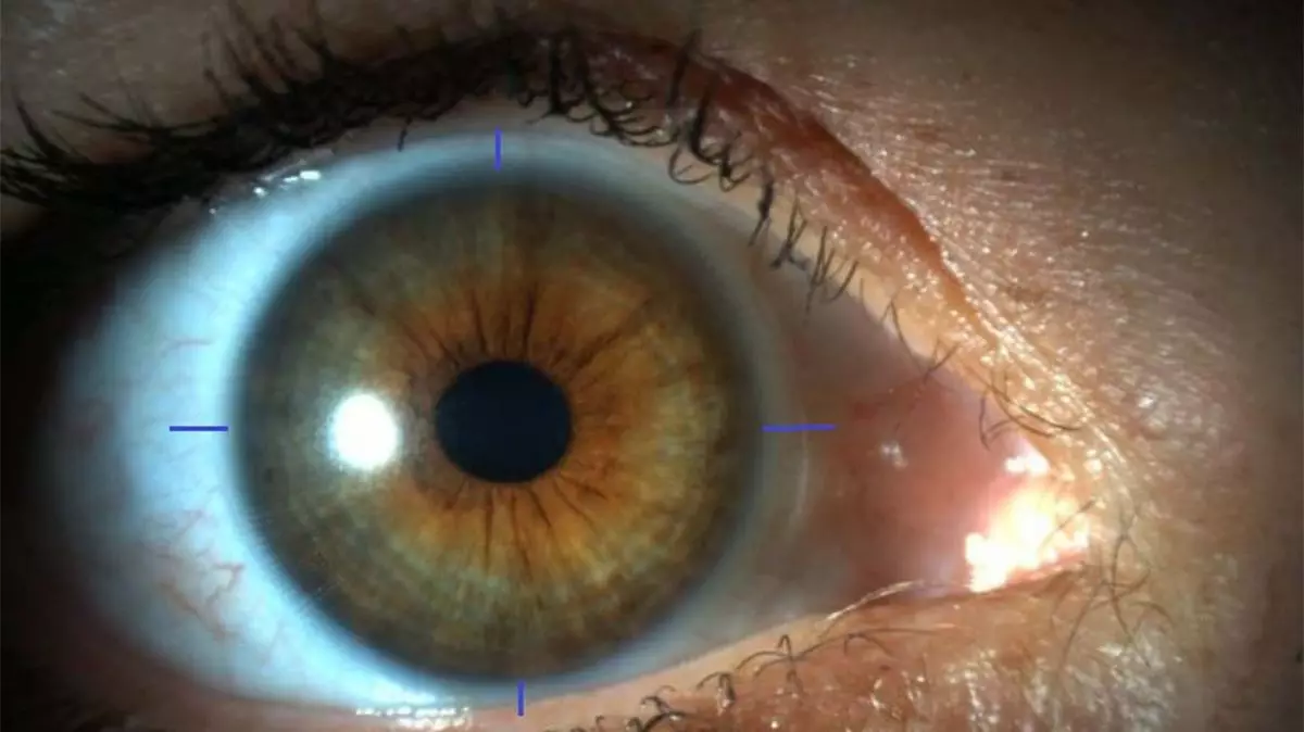 Øynene har det: Forskere 3-D Print Human Corneas
