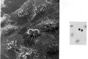 Amaseli e-HeLa ahlukana ngaphansi kwe-electron microscopy.