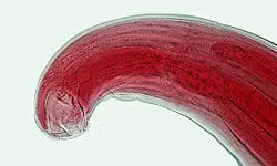 Xi nies isostnu li l-hookworm (ara hawn) għandu l-abbiltà li jfejjaq kollox mill-allerġiji għall-ażma.