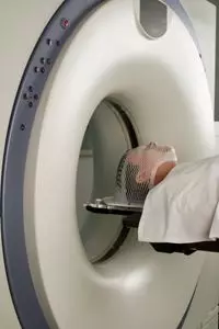 Maaaring gamitin ang isang CT scan upang matukoy ang kalubhaan ng isang concussion.