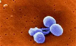 Streptococcus pneumoniae, seperti yang terlihat dalam pemindaian mikrograf elektron.