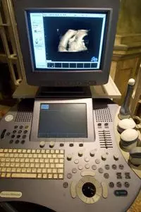 Alat ultrasound portabel ge tiasa dibawa ka pasien, sanés sabalikna.