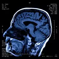 Scansioni MRI come questa possono rilevare quali aree ricevono ossigeno (e sono quindi attive). Queste scansioni hanno fatto luce sul nostro senso di altruismo.
