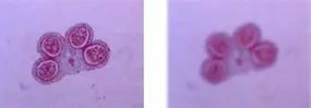 Imagen de un grano de polen enfocado (izquierda) y desenfocado (derecha)