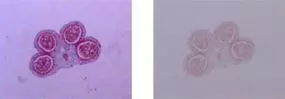 Imagen de grano de polen con buen contraste (izquierda) y poco contraste (derecha)