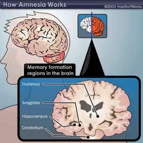 Régions primaires du cerveau où les souvenirs sont créés et stockés.