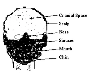 腦血流研究顯示沒有血液進入大腦